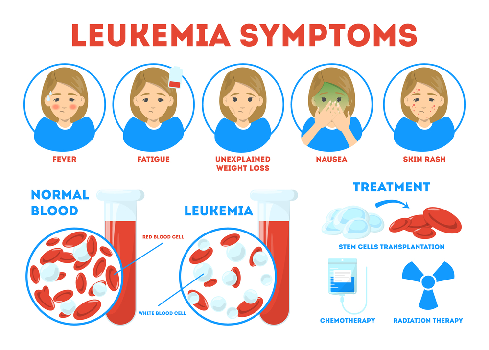 6 Info Tentang Kanker Darah yang Simpang Siur. Kanker Darah = Leukimia?