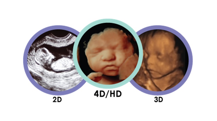 Meski Mahal, Ini Alasan USG 4D Makin Diminati. Wajah Bayi Terlihat Nyata!